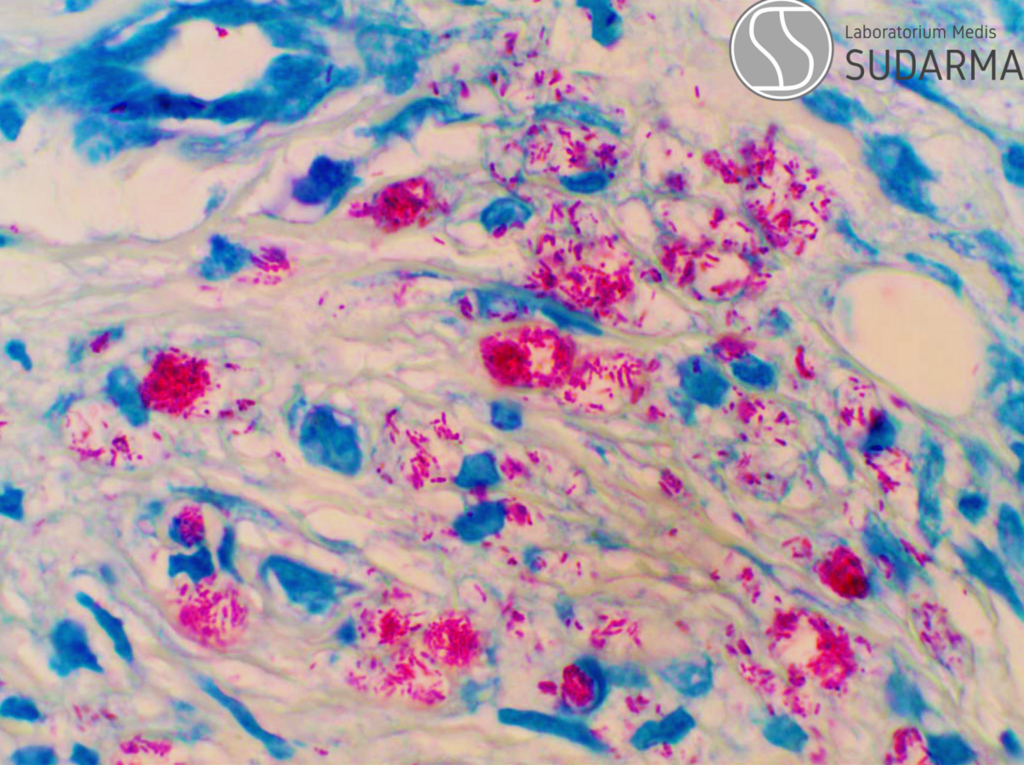 Daftar Pemeriksaan - Laboratorium Sudarma
